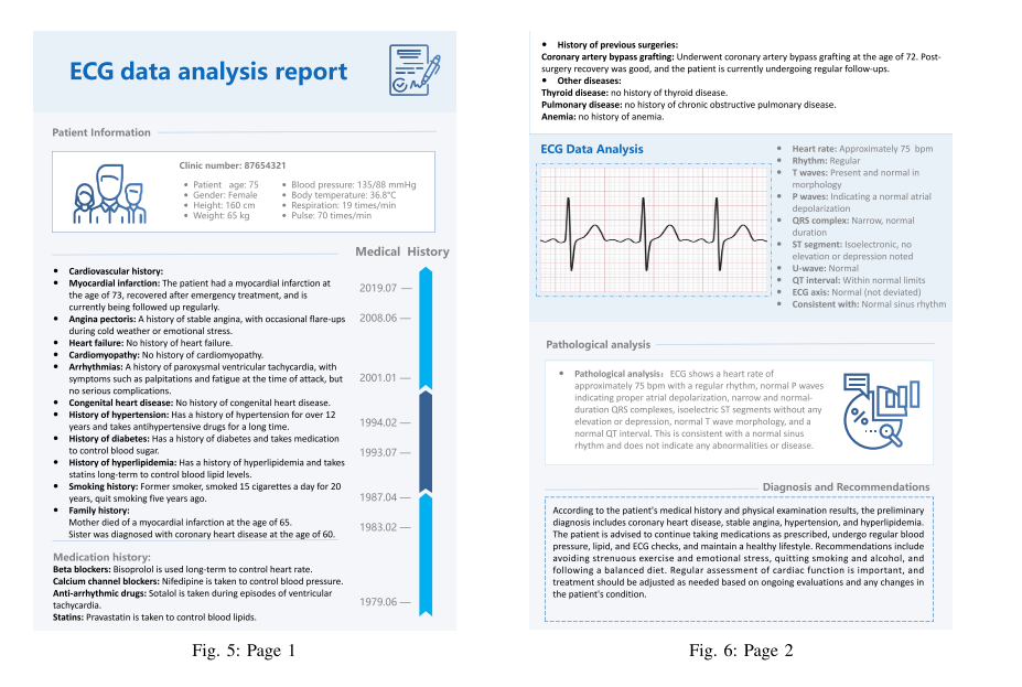 ECG-Chat: A Large ECG-Language Model forCardiac Disease Diagnosis-CSDN博客