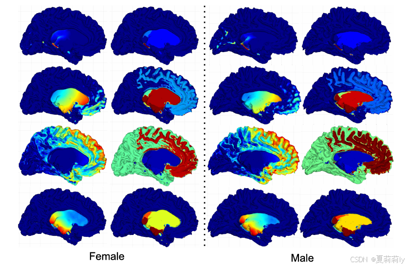 [TPAMI 2022]Learnable Pooling in Graph Convolutional Networks for Brain Surface Analysis-CSDN博客