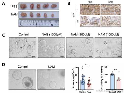 Gut（IF：23.1）丨南方医科大学何肖龙团队揭示肠道菌群通过代谢物靶向调控宿主细胞的新机制_gut microbial-derived n-acetylmuramic acid ...