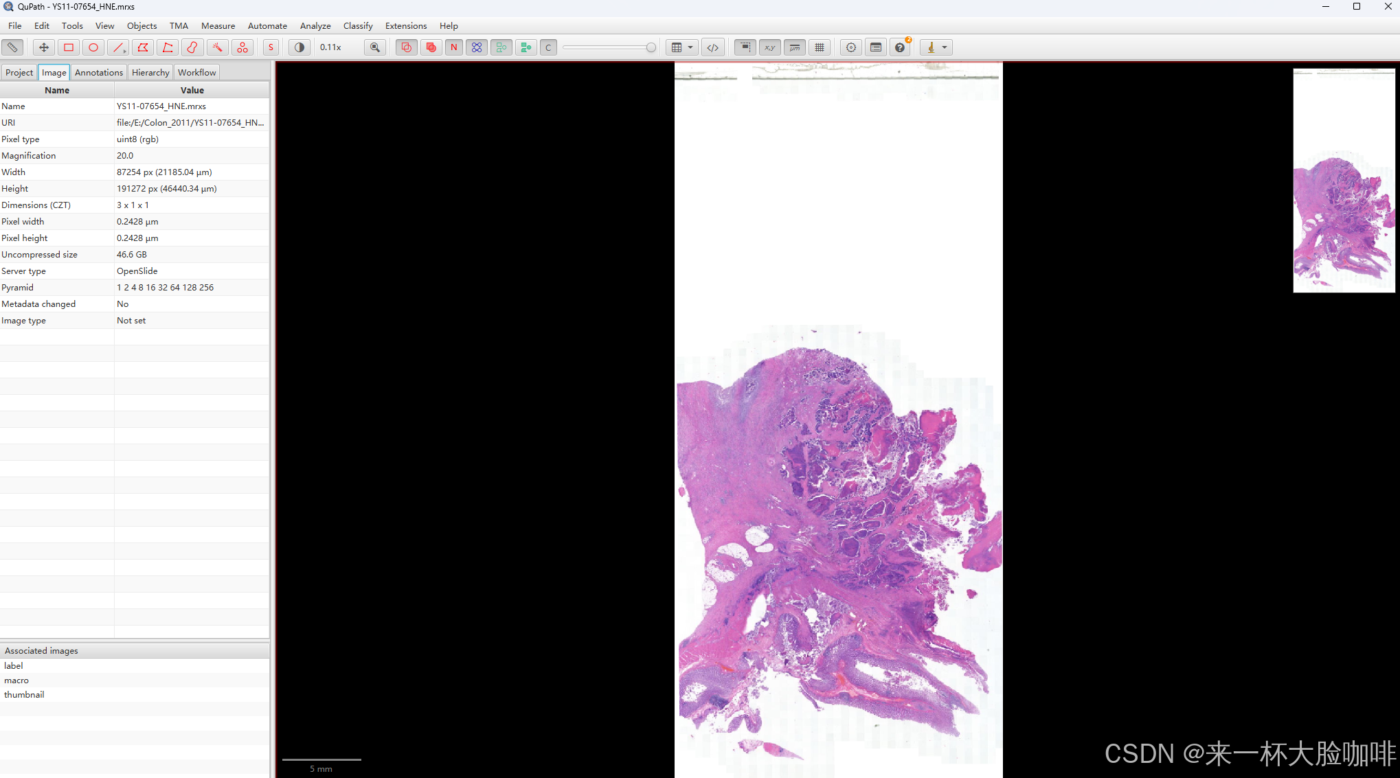 Deepzoom和Openslide处理WSI时的异同及问题解决_openslide读取wsi-CSDN博客