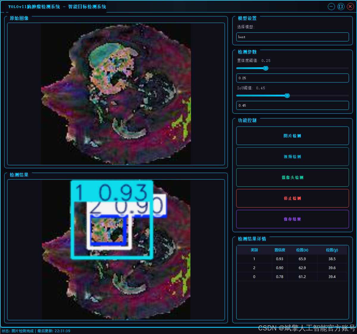 基于深度学习YOLOv11的脑肿瘤检测系统（YOLOv11+YOLO数据集+UI界面+登录注册界面+Python项目源码+模型）-CSDN博客