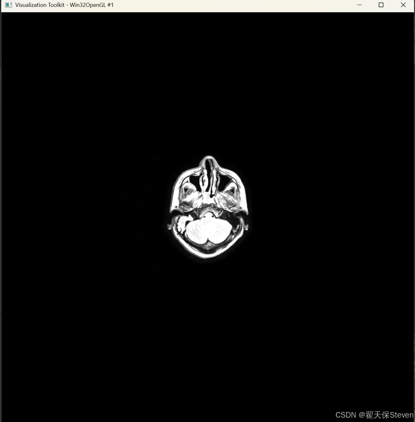 VTK-读取Dicom图像并显示-CSDN博客