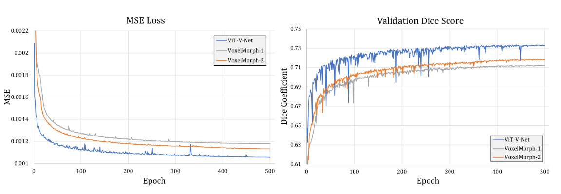 【论文笔记】ViT-V-Net无监督医学图像配准-CSDN博客