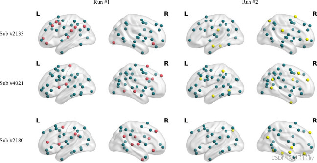 [论文精读]A unified framework for personalized regions selection and functional relation modeling ...