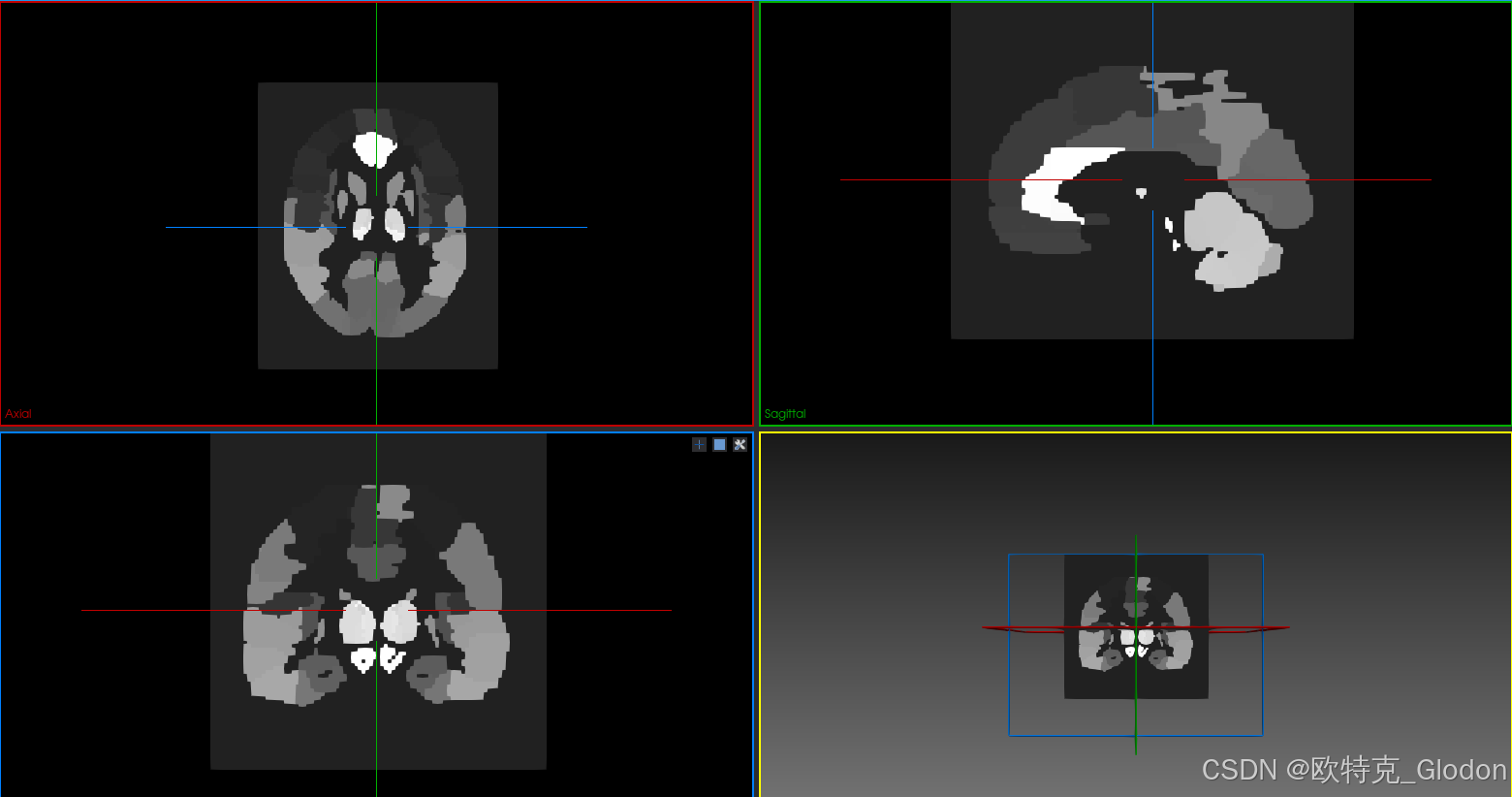3D医学影像开发＜七＞：利用AAL模板实现脑功能区的自动划分_aal脑区划分-CSDN博客