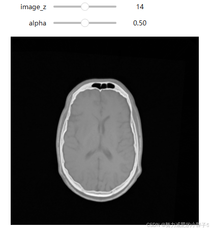 simpleITK - Registration - SimpleITKv4配准简介_simpleitk图像配准-CSDN博客