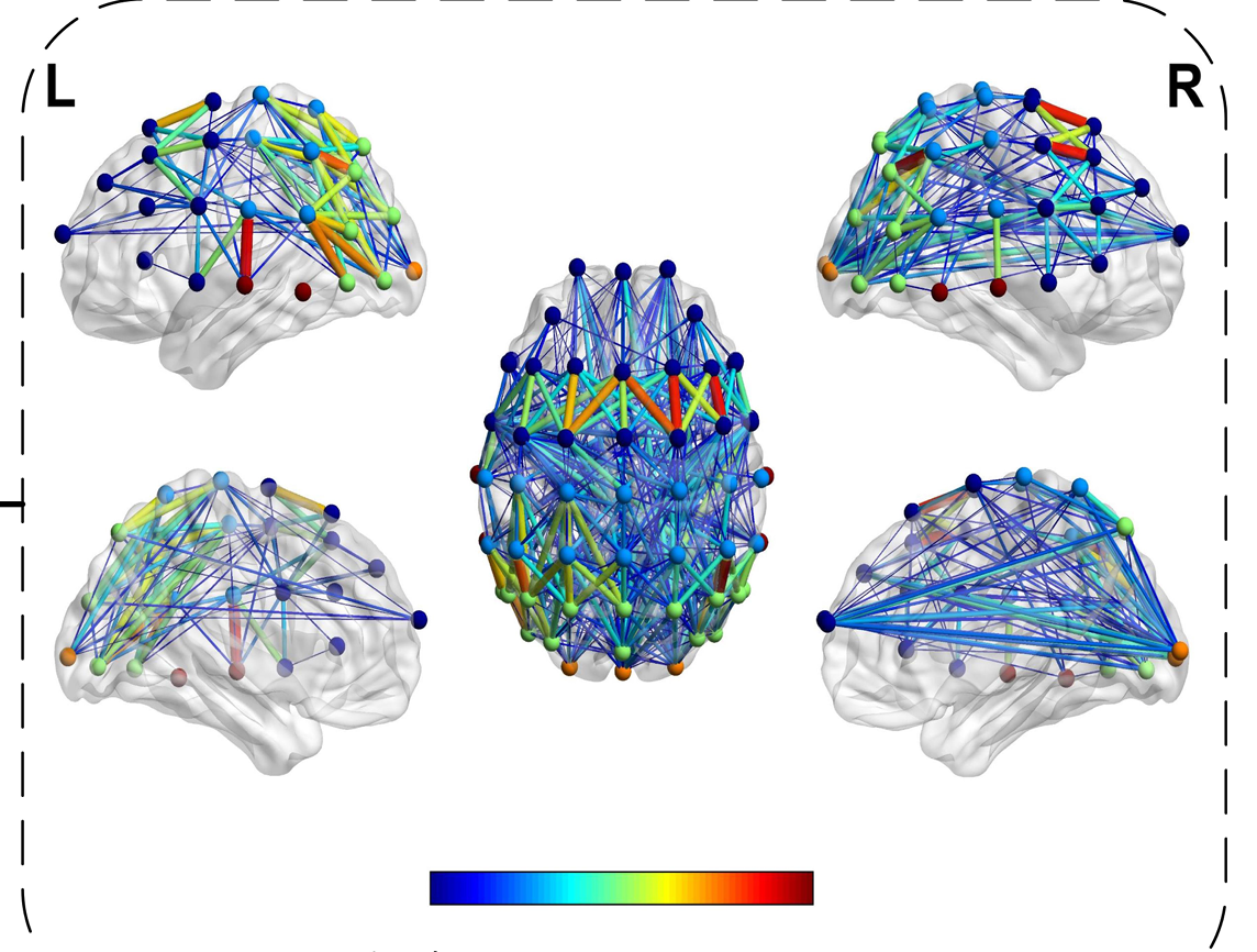 研一脑电小白进阶版 之 使用BrainNet Viewer构建脑功能网络图-CSDN博客