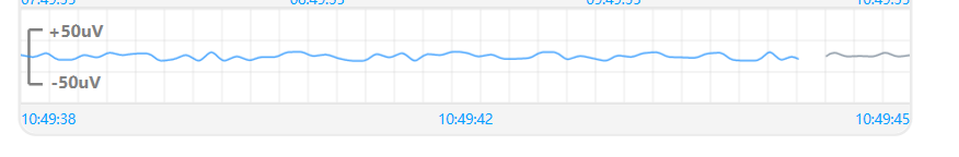 WPF开发随笔-使用livecharts2模拟绘制脑电图心电图肌电图_wpf livechart2-CSDN博客