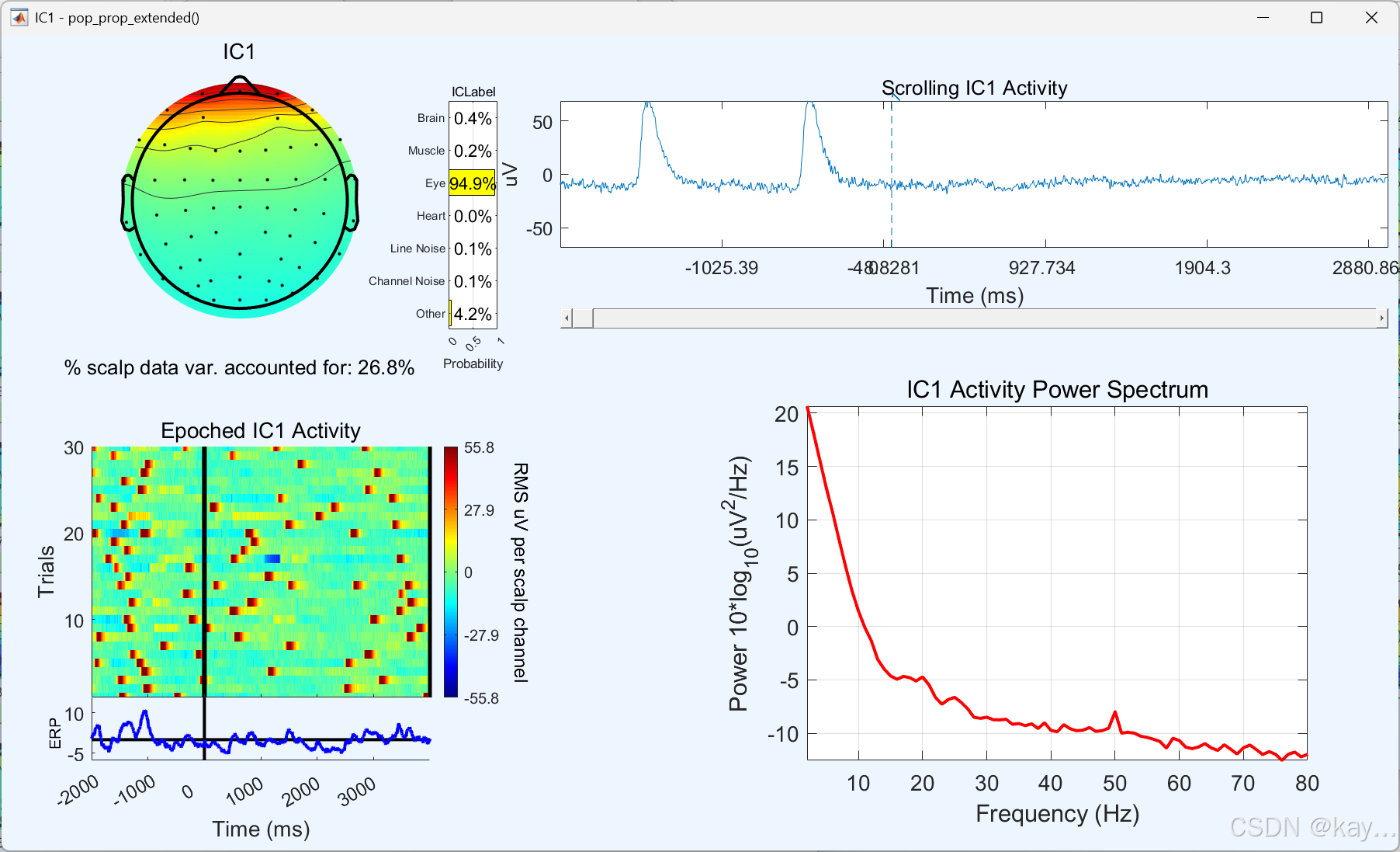 研一脑电小白日记 之 预处理脑电数据_neuracle eeg data-CSDN博客
