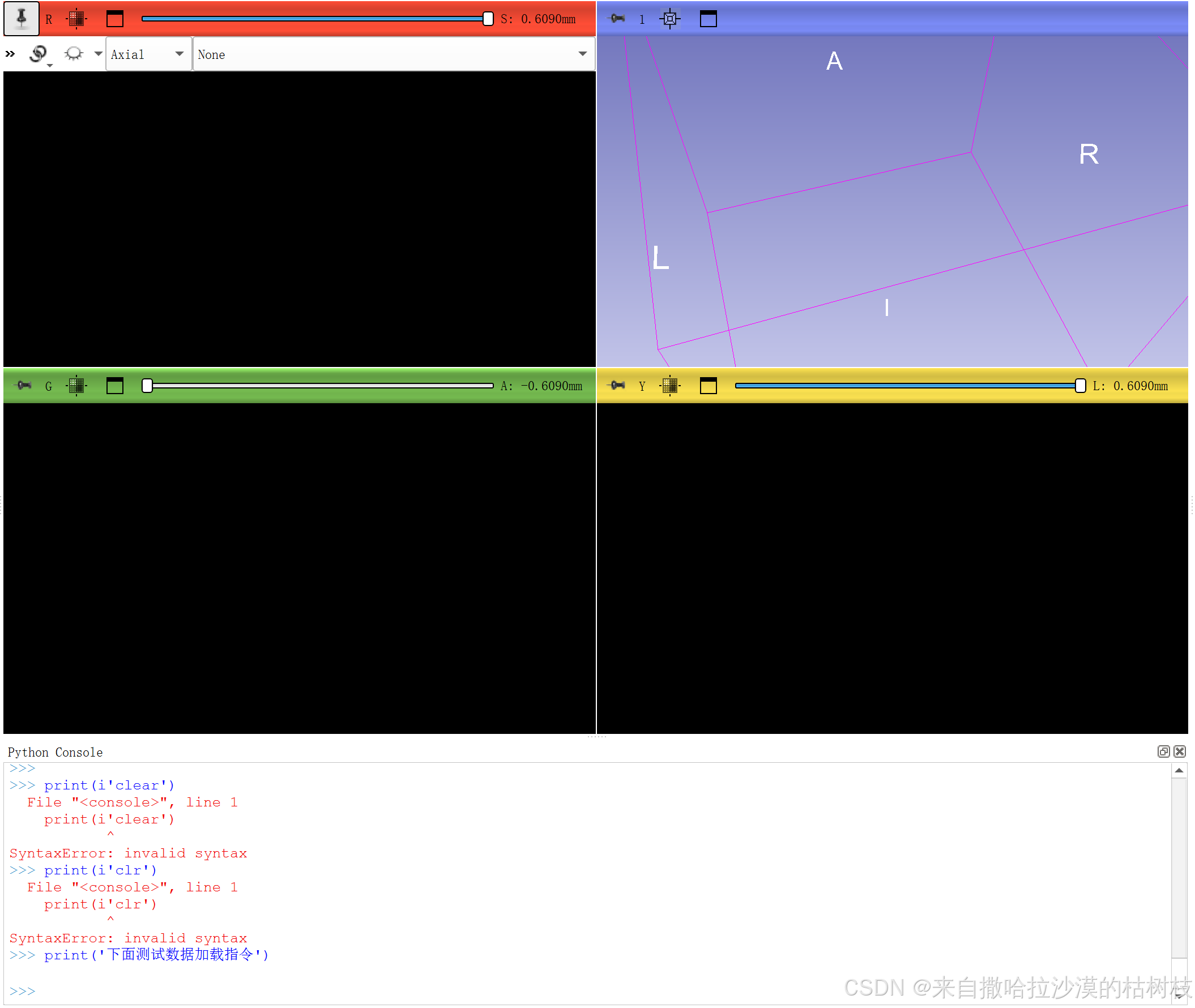 3d Slicer Python插件制作二 Slicerutil函数方法的试验 Csdn博客