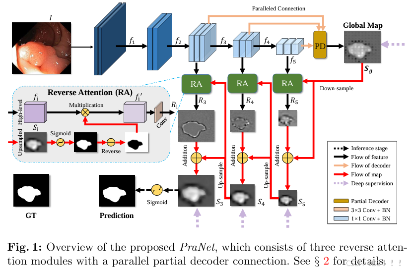 【结肠息肉AI论文集】PraNet: Parallel Reverse Attention Network for Polyp Segmentation-CSDN博客