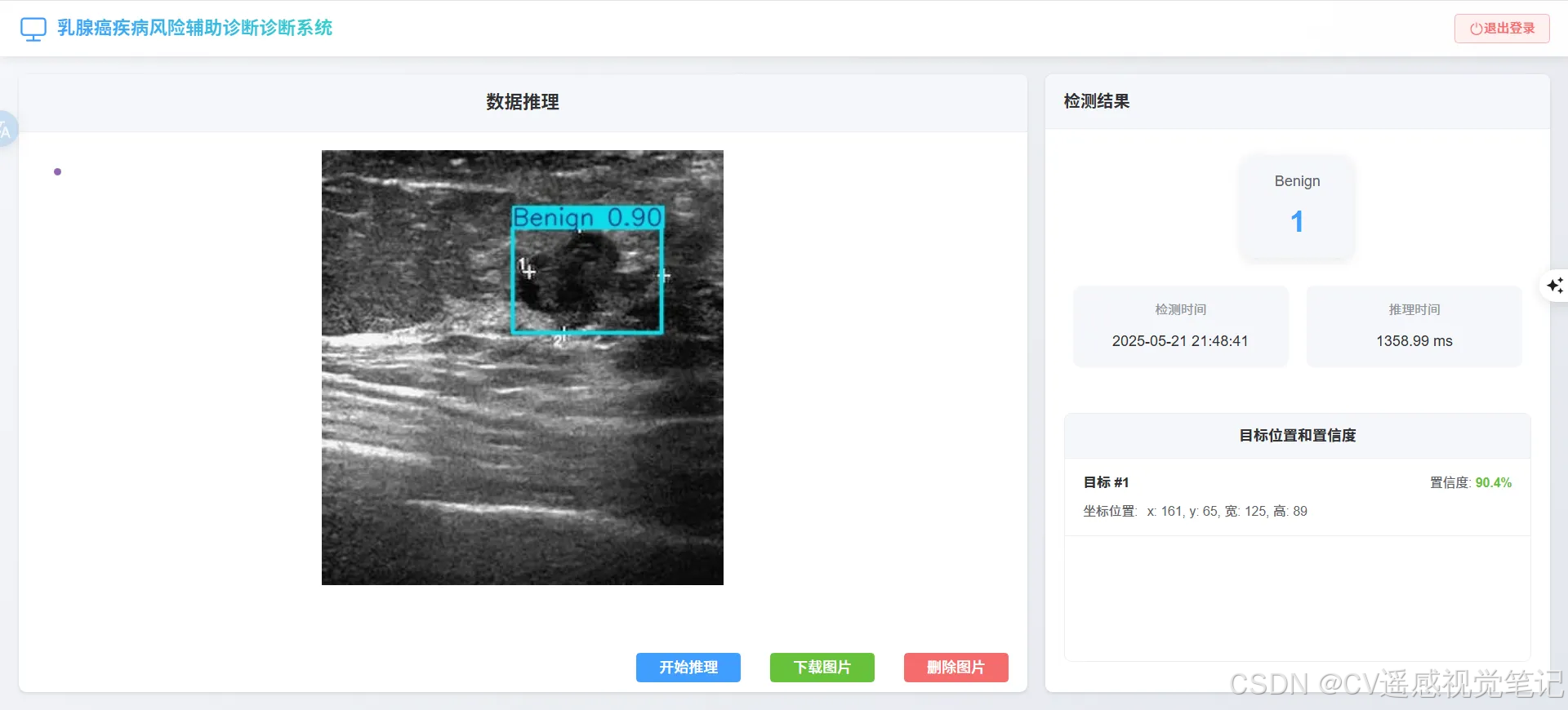 基于FastAPI+YOLO的乳腺癌检测系统前后端实战（附完整源码）_yolo怎么做前后端-CSDN博客