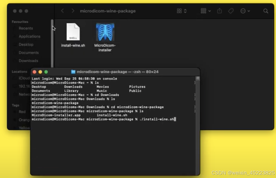 MacOS安装microdicom【高效无坑版】_microdicom mac-CSDN博客