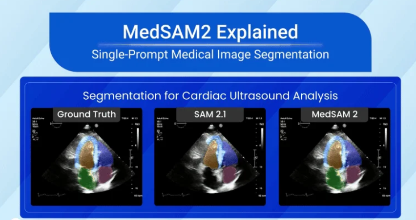 医疗影像AI大突破！MedSAM2 一键搞定动态视频分割，医生效率翻10倍！-CSDN博客