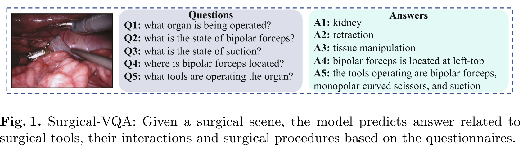 【文献阅读】Surgical-VQA: Visual Question Answering in Surgical Scenes using Transformer-CSDN博客