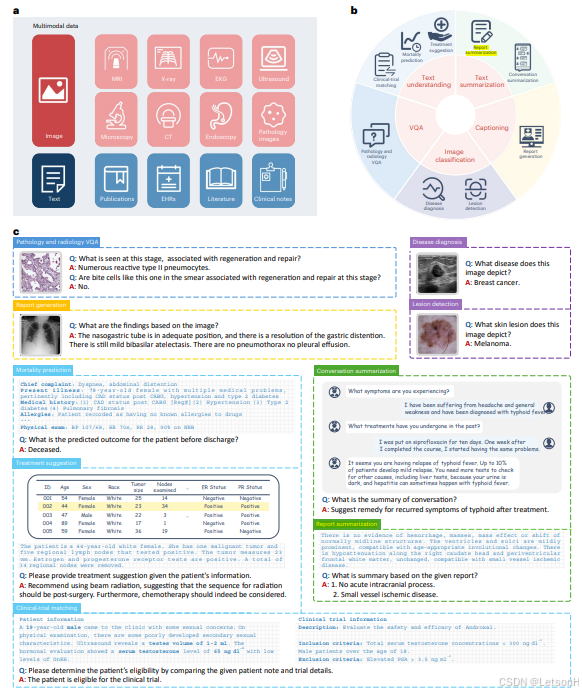 【Nature medicine】A generalist vision–language foundation model for diverse biomedical tasks-CSDN博客