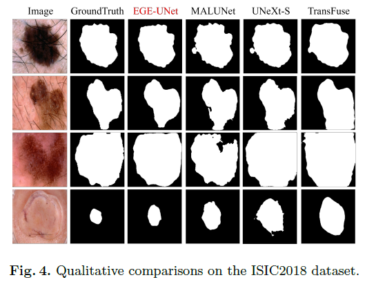 EGE-UNet：一种有效的分组增强UNet皮肤病灶分割方法-CSDN博客