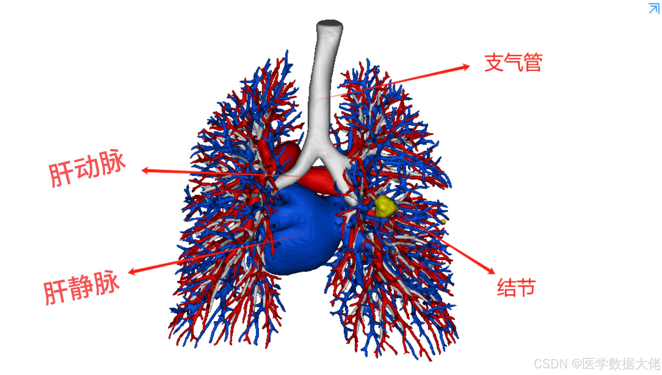 「肝脏CT三维数据集开放下载」肝十八段+结节+血管全标注，科研/临床/开发者必备_肝癌ct数据集下载-CSDN博客