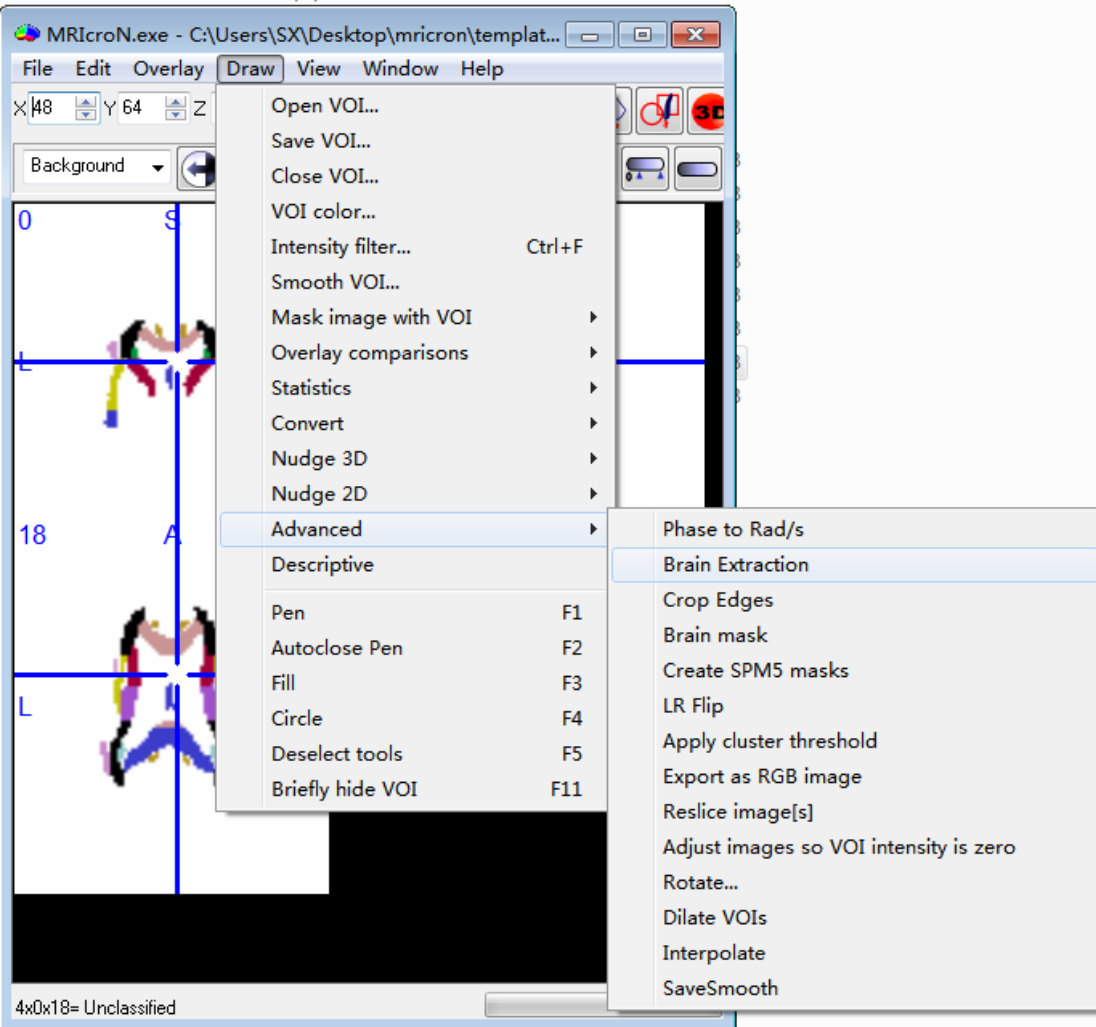 MRIcron去除颅骨-CSDN博客