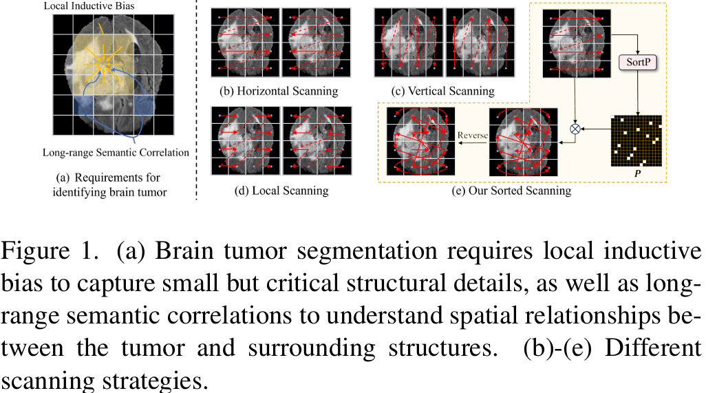 CVPR 2025 | Incomplete Multi-modal Brain Tumor Segmentation via Learnable Sorting State Space ...