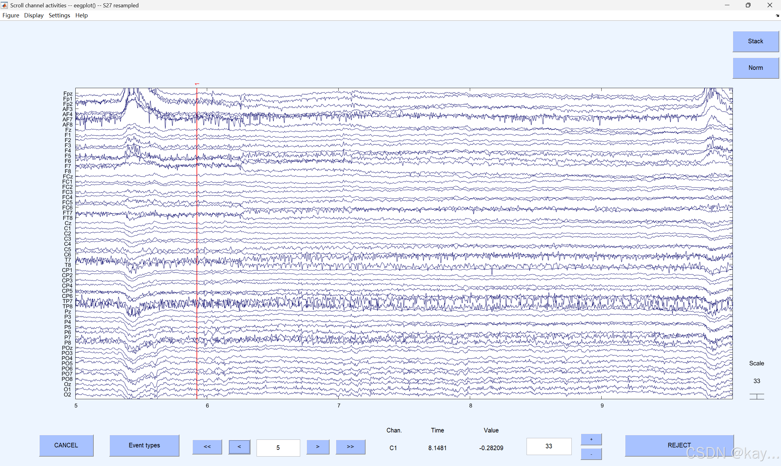 研一脑电小白日记 之 预处理脑电数据_neuracle eeg data-CSDN博客
