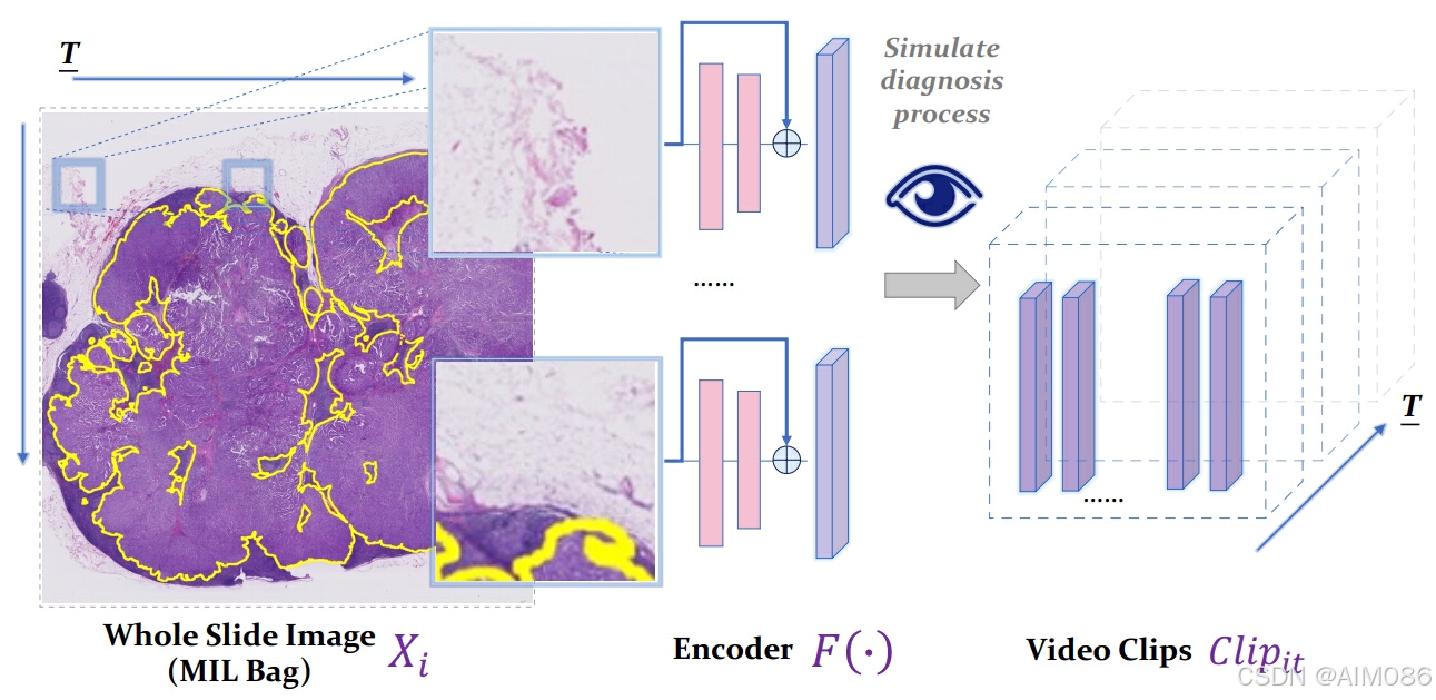 【阅读笔记】Transformer + 多实例学习---视频结构的全切片图像分类_wsi中的patch是什么-CSDN博客