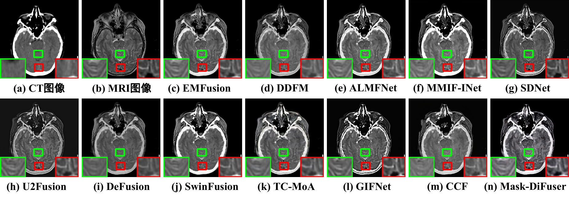 IEEE TPAMI 25| Mask-DiFuser: A Masked Diffusion Model for Unified ...