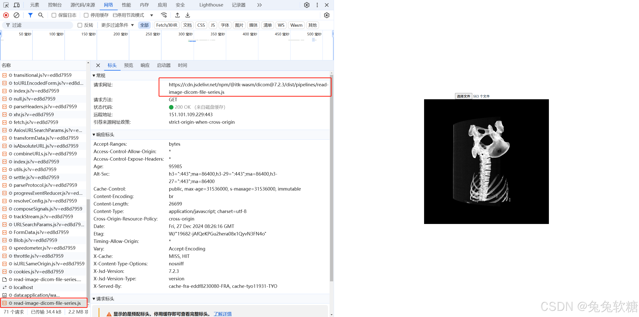 Vue+vtk.js+itk生成一组.dcm文件的三维模型_vtk.js dicom-CSDN博客