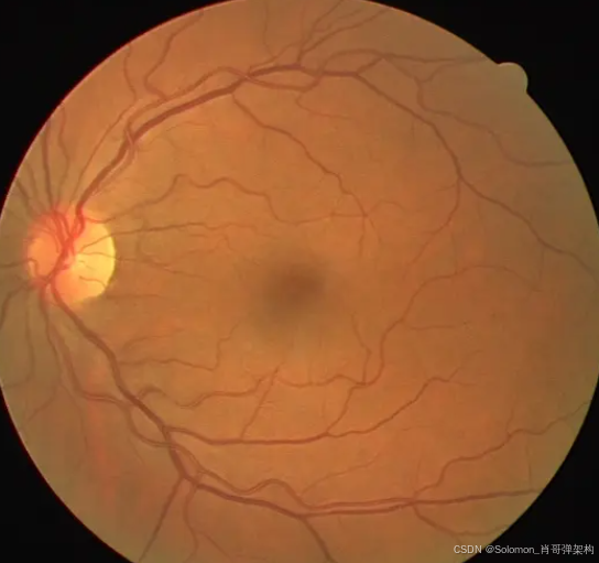 Python U-Net 实现医学影像分割-CSDN博客