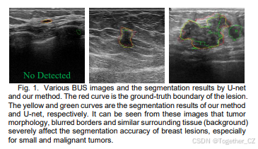 AAU-net:An Adaptive Attention U-net for BreastLesions Segmentation in Ultrasound Images用于超声图像中乳腺 ...