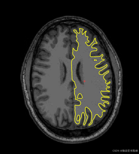 Workbench View 可视化(FreeSurfer2Workbench)问题小结_freesurfer 可视化-CSDN博客