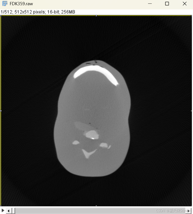 DCMTK-Raw原始图像数据转Dicom标准格式_raw to dicom-CSDN博客