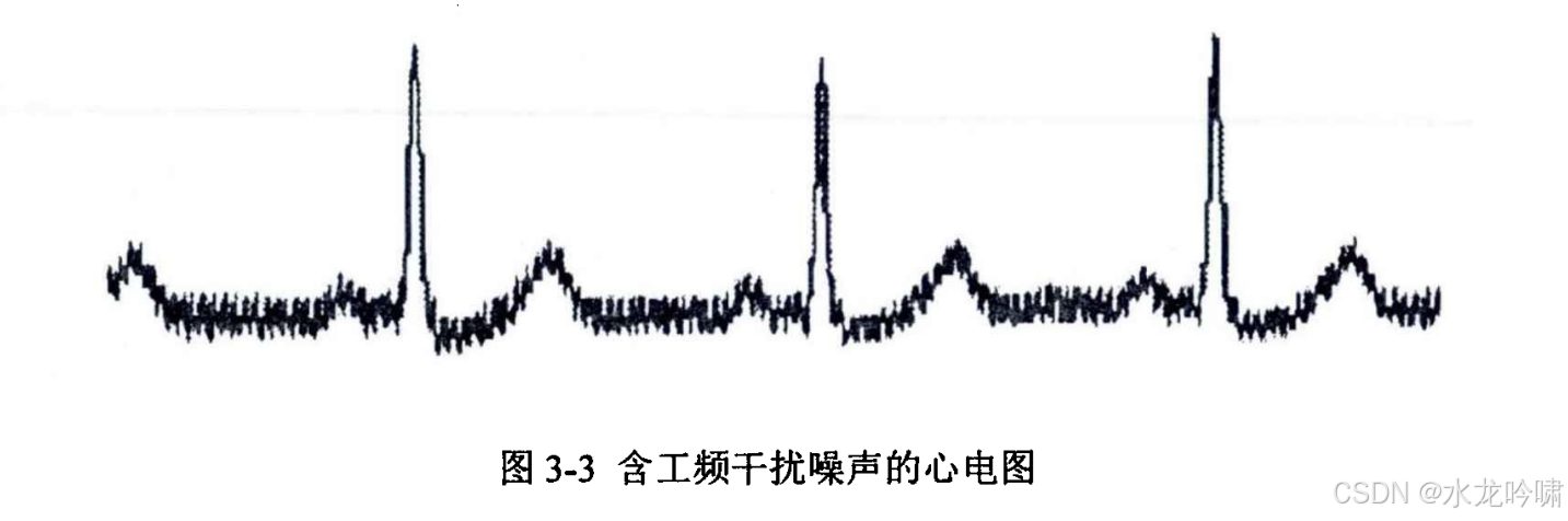 信号与系统工程实践--ECG（心电图）_ecg信号-CSDN博客