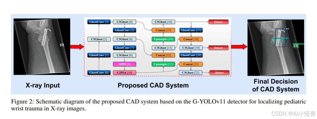 YOLO论文分享（4）：轻量化 G-YOLOv11：基于Ghost Convolution的高效儿童腕部 X 光骨折检测_g-yolo11-CSDN博客