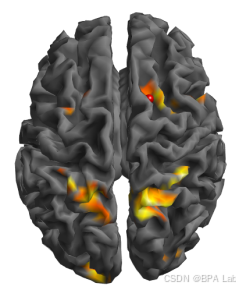 【入门且详细！fMRI信号一阶处理操作流程笔记】SPM12版_fmri glm分析spm-CSDN博客