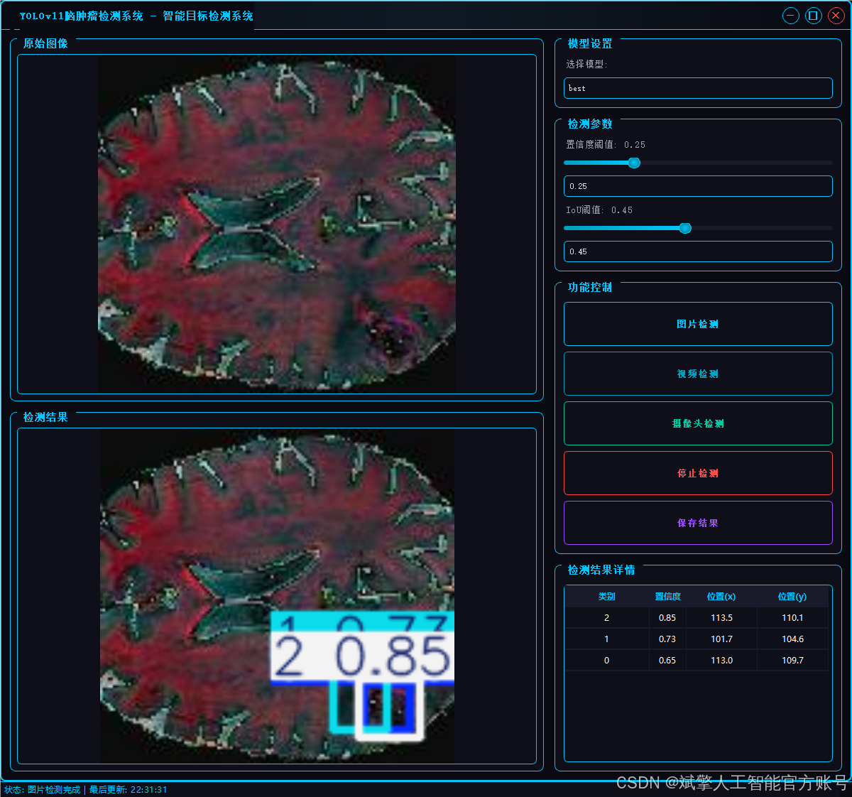 基于深度学习YOLOv11的脑肿瘤检测系统（YOLOv11+YOLO数据集+UI界面+登录注册界面+Python项目源码+模型）-CSDN博客
