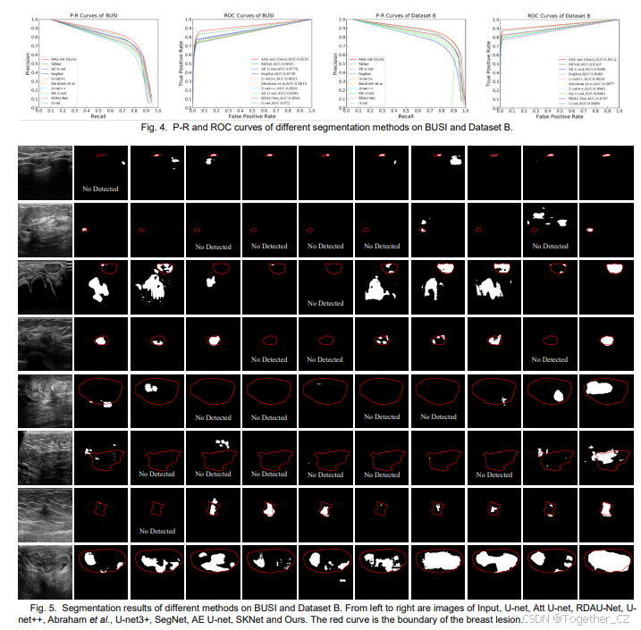 AAU-net:An Adaptive Attention U-net for BreastLesions Segmentation in Ultrasound Images用于超声图像中乳腺 ...