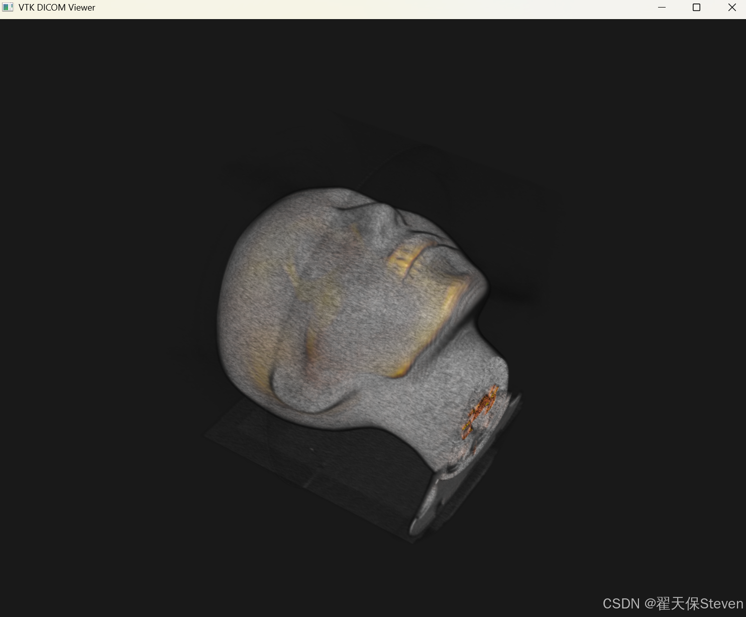 VTK-DICOM序列三维体渲染与可视化_vtk dicom 显示 rgb24-CSDN博客