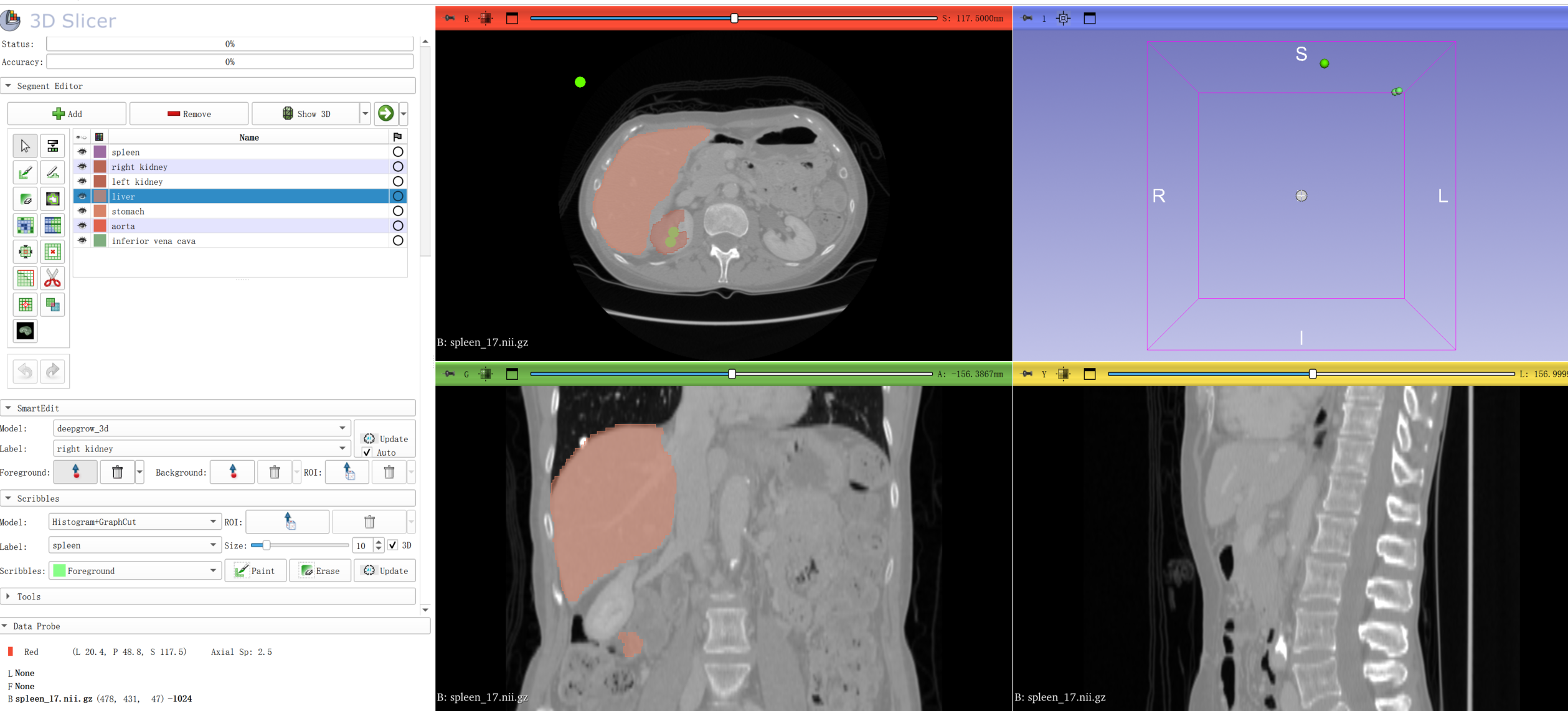 在3D slicer中使用MONAI Label-CSDN博客