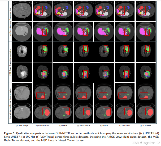 D-Net: Dynamic Large Kernel with Dynamic Feature Fusion for Volumetric ...