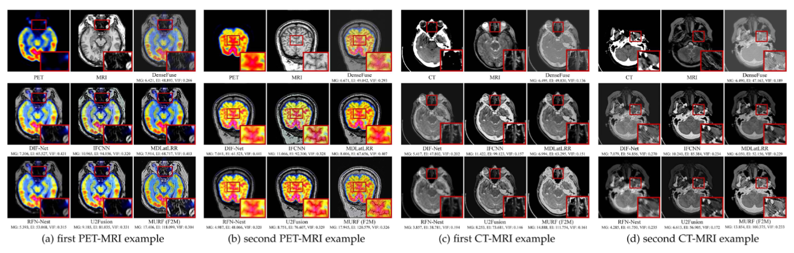 MURF: Mutually Reinforcing Multi-Modal Image Registration and Fusion-CSDN博客