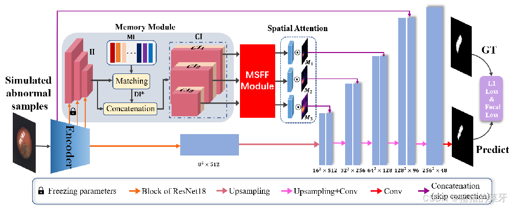 MemSeg: A semi-supervised method for image surface defectdetection using differences ...