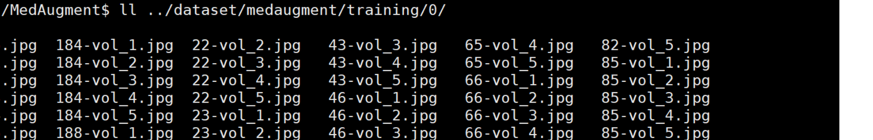 MedAugment：基于医学图像的数据增强方法（针对分类问题及图像分割问题）_医学图像分割中数据增强-CSDN博客