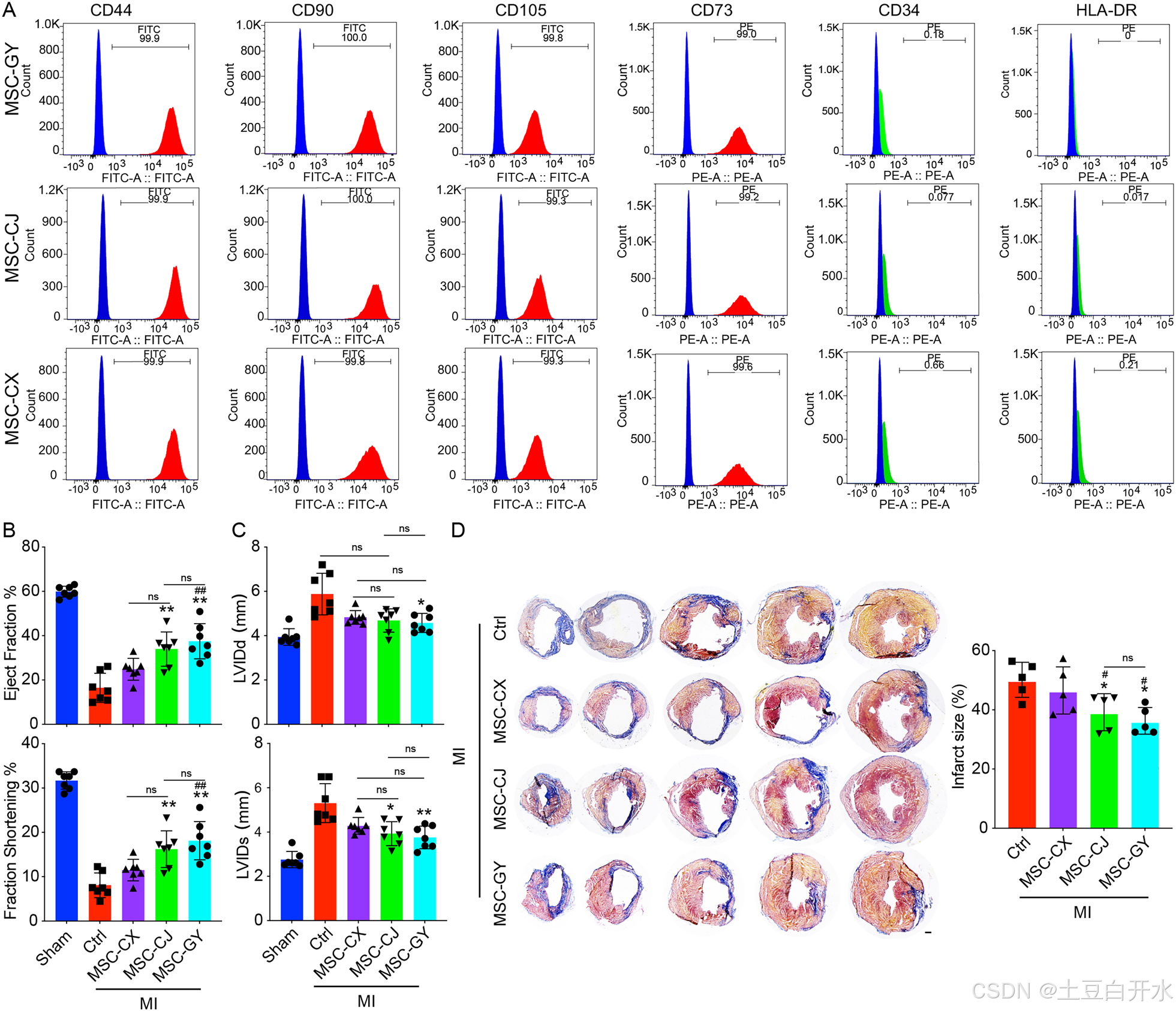 N-CADHERIN+/CD168- subpopulation determines therapeutic variations of ...