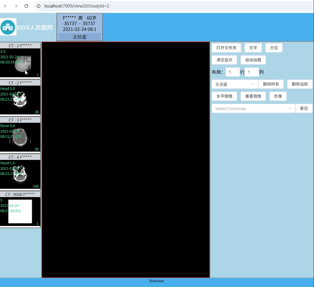 基于cornerstone3D的dicom影像浏览器 第十二章 镜像、负像、旋转、伪彩、复位_cornerstone-core 渲染3d dicom-CSDN博客