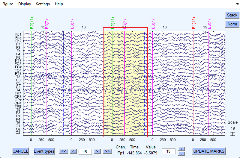 eeglab-进阶篇（ERP）_eeglab叠加平均-CSDN博客