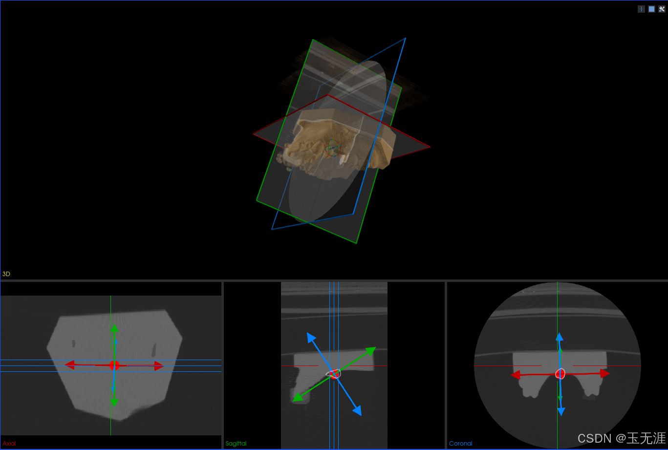 MITK实战篇-MITK切片导航_mitk ct值是在哪里显示的-CSDN博客