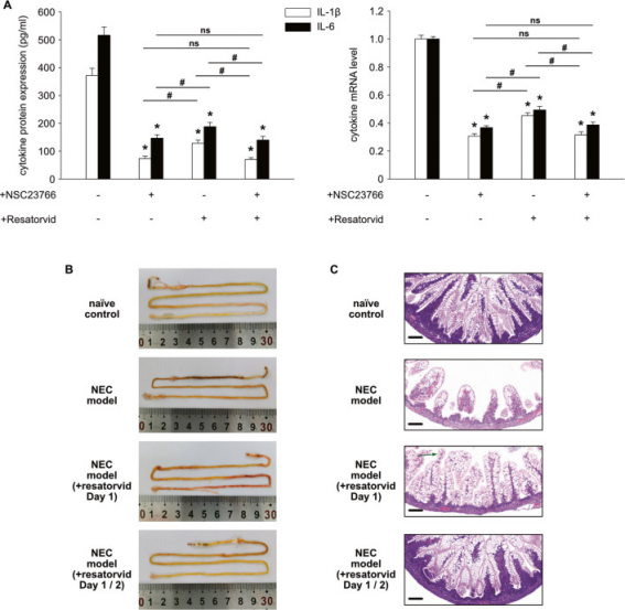 AbMole丨综述：免疫调控的关键靶点--Toll样受体（TLR），及其常用抑制剂/激动剂全解析-CSDN博客