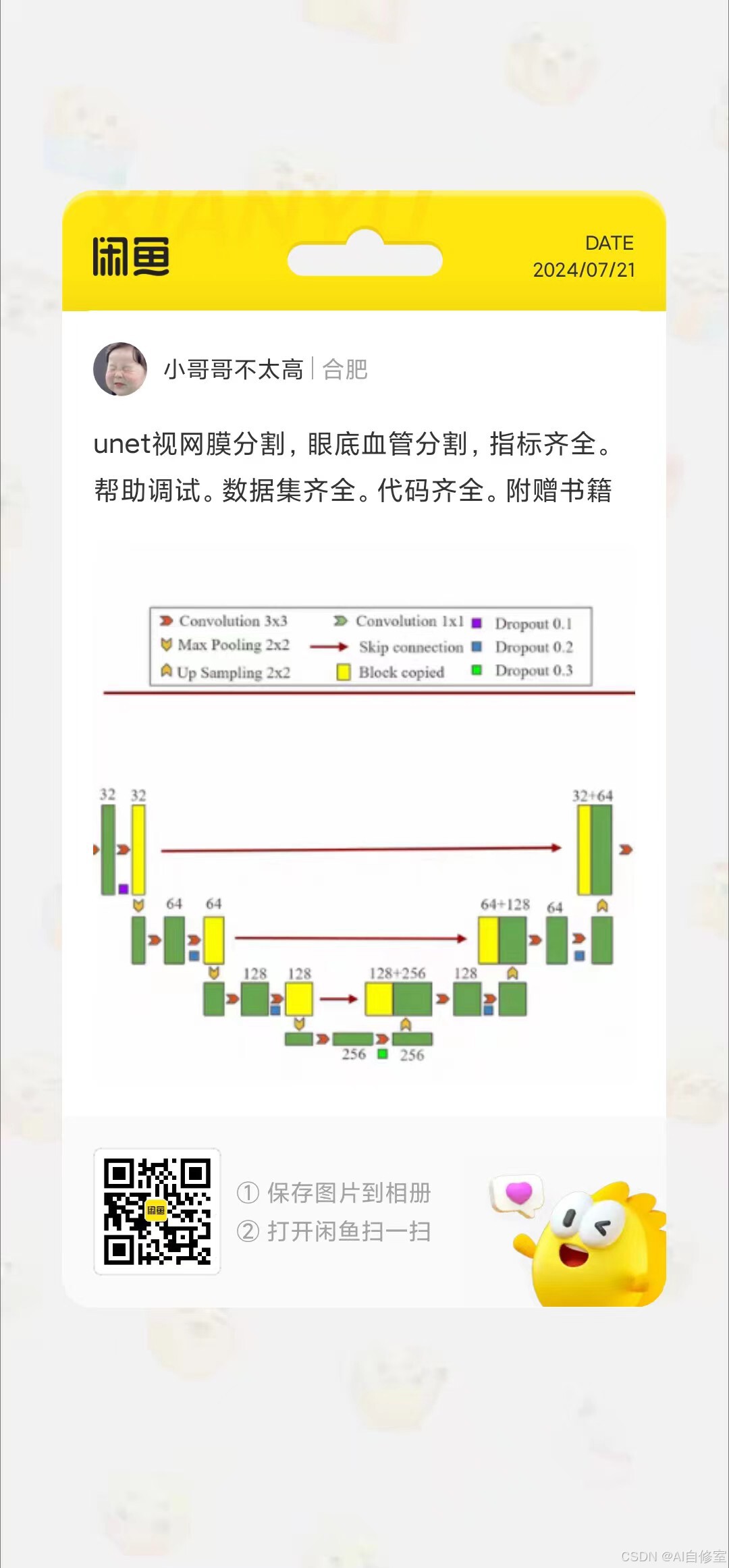 基于u Net的视网膜血管分割(pytorch完整版)基于u Net的视网膜图像血管分割 Csdn博客