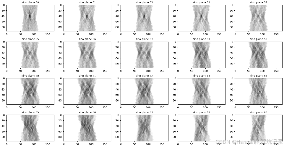 手把手Parallelproj重建PET hoffman数字体模(sinogram MLEM重建)-CSDN博客